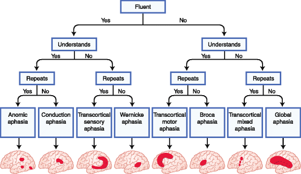 Borderzone Strokes and Transcortical Aphasia | SpringerLink