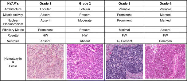 Prognosis and Biology in Esthesioneuroblastoma: the Emerging Role of Hyams Grading System ...