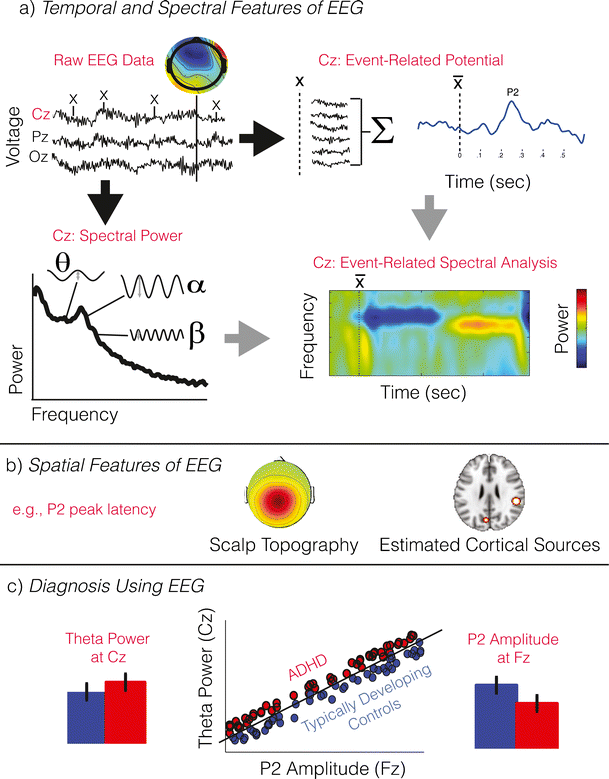 Use of EEG to Diagnose ADHD | SpringerLink