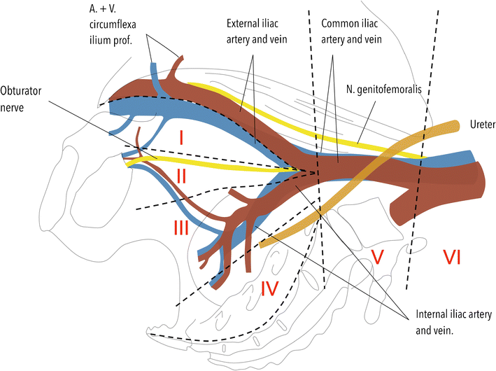 Therapeutic Value of Standard Versus Extended Pelvic Lymph Node ...