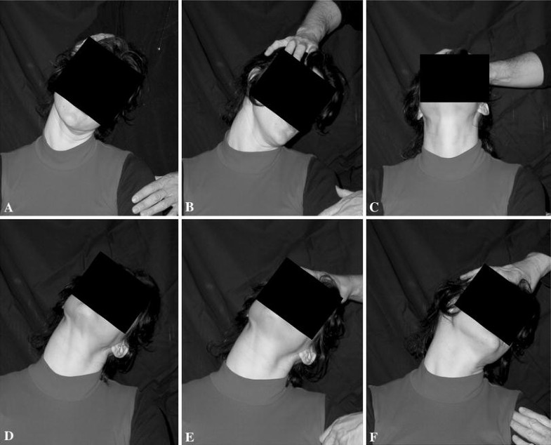 What is the Best Way to Apply the Spurling Test for Cervical ...