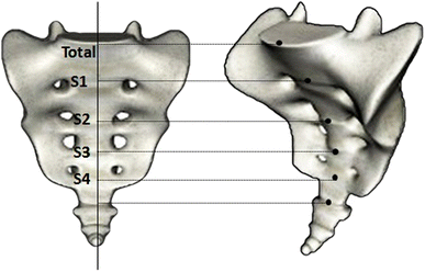 How Does the Level of Sacral Resection for Primary Malignant Bone ...