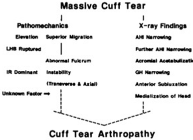 Classifications in Brief: Hamada Classification of Massive Rotator Cuff ...