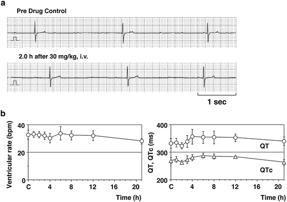 Azithromycin Can Prolong QT Interval and Suppress Ventricular ...