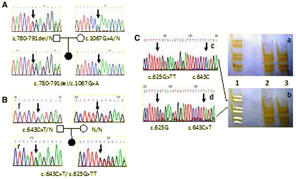 Oculocutaneous Albinism Type 3 (OCA3): Analysis of Two Novel Mutations ...