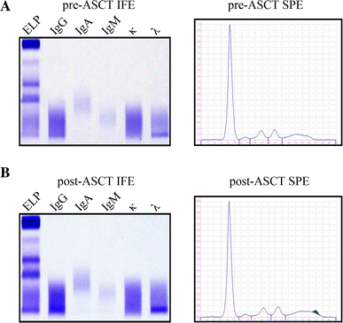 Comparison of SPE, IFE, and FLC in Monitoring Patients with Multiple ...