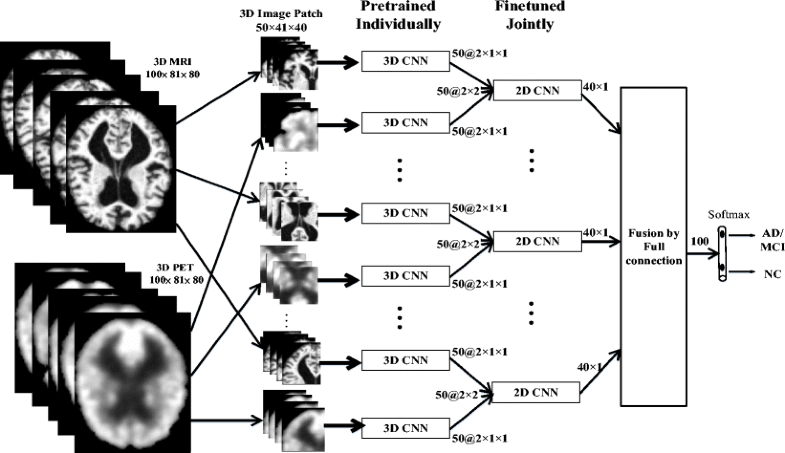 Multi-Modality Cascaded Convolutional Neural Networks for Alzheimer’s Disease Diagnosis ...