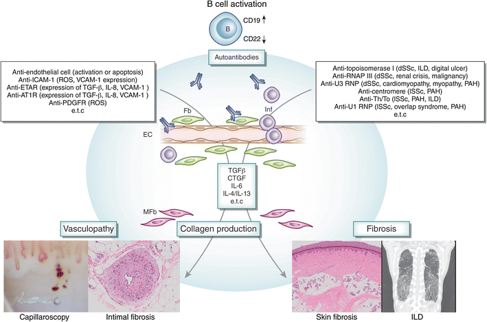 Pathogenesis of systemic sclerosis—current concept and emerging ...