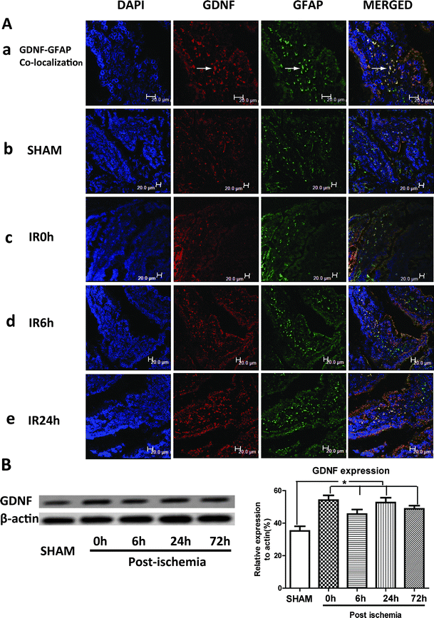 GDNF is Involved in the Barrier-Inducing Effect of Enteric Glial Cells ...