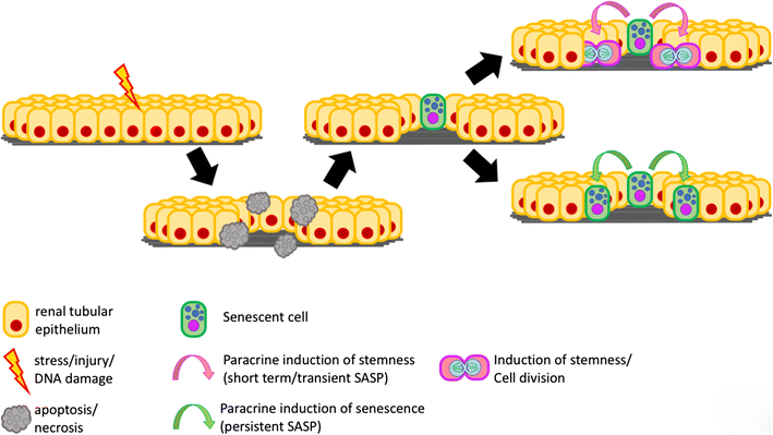 Cellular senescence in the aging and diseased kidney | SpringerLink