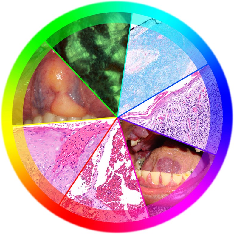 A Rainbow of Colors and Spectrum of Textures: An Approach to Oral ...