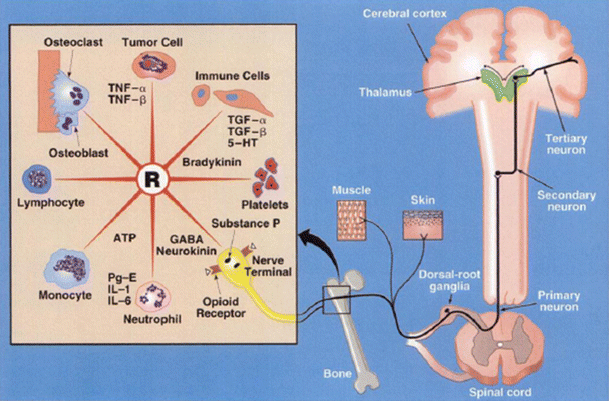 Effective use of strontium-89 in osseous metastases | SpringerLink