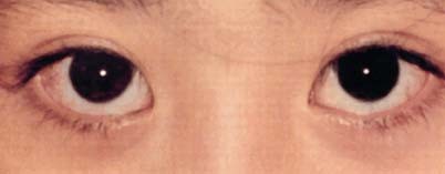 Kawasaki-Syndrom | SpringerLink