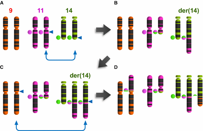 PAX5-positive plasma cell myeloma with t(9;14;11)(p13;q32;q13), a novel ...