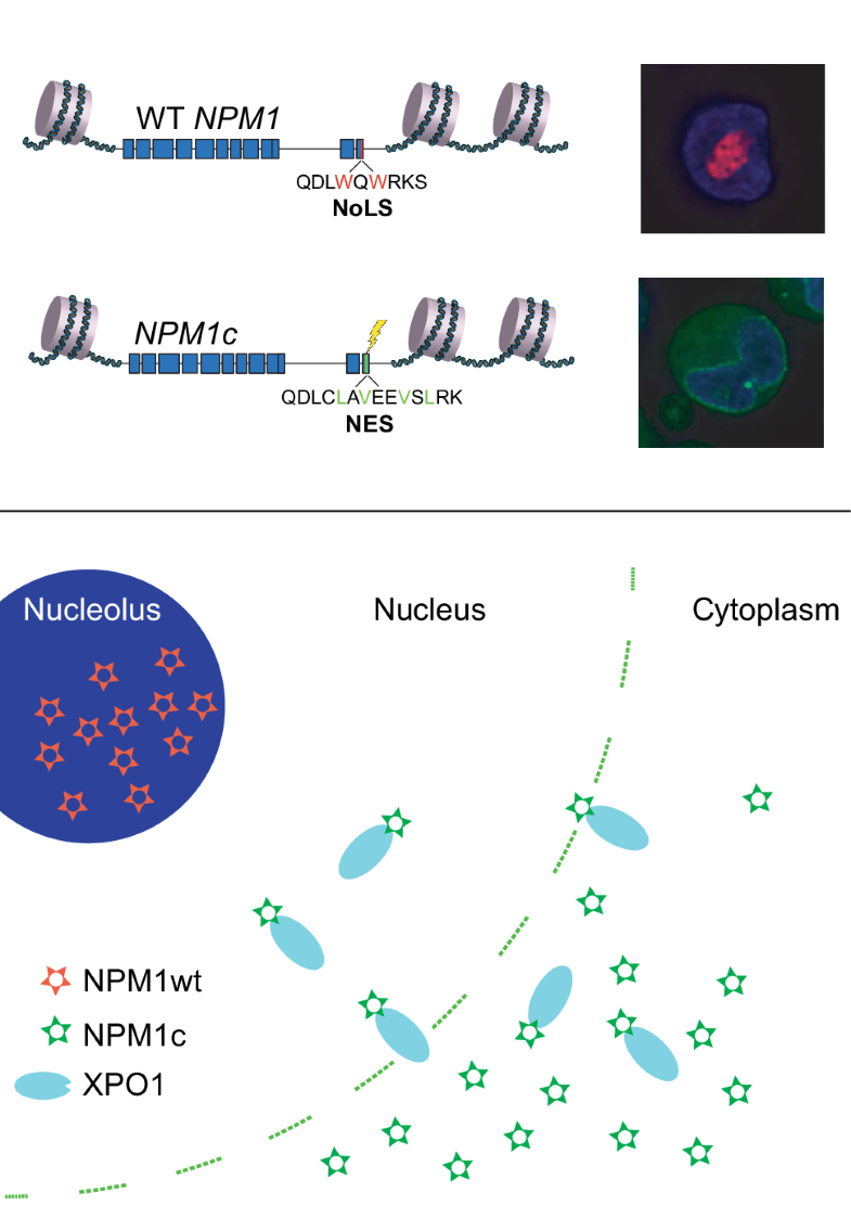New insights into the biology of acute myeloid leukemia with mutated ...
