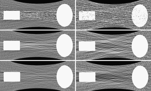 Photon starvation artifacts of X-ray CT: their true cause and a solution | SpringerLink