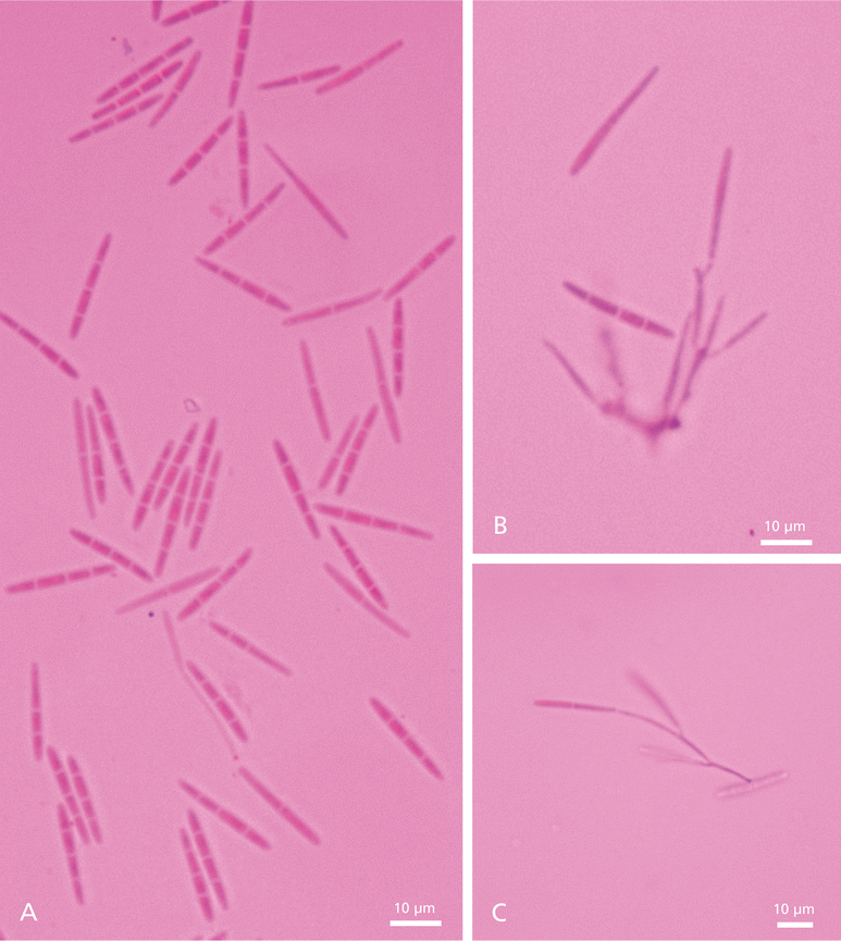 A new fungicolous Scolecobasidium (hyphomycetes) and Caducirostrum gen ...