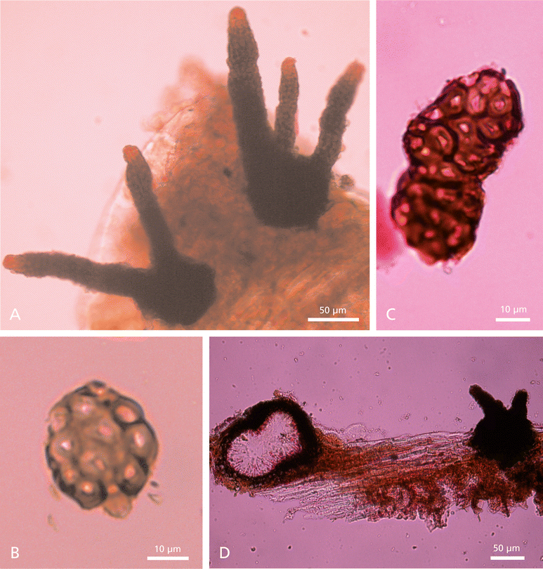 A new fungicolous Scolecobasidium (hyphomycetes) and Caducirostrum gen ...