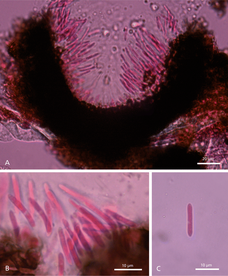 A new fungicolous Scolecobasidium (hyphomycetes) and Caducirostrum gen ...