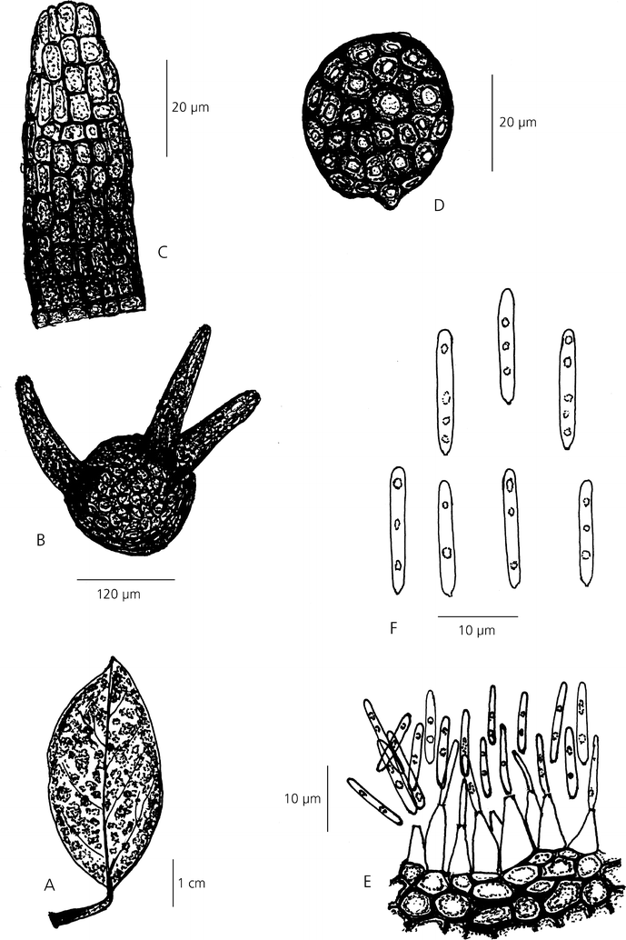 A new fungicolous Scolecobasidium (hyphomycetes) and Caducirostrum gen ...