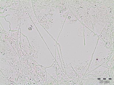 Diagnosis of Dermatophytosis | SpringerLink