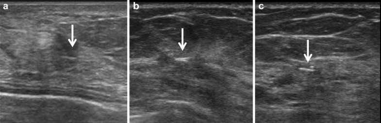Evaluation of the sonographic visibility and sonographic appearance of ...