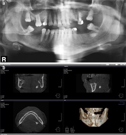 Radiologische Bildgebung und Strahlenexposition in der Mund-, Kiefer ...
