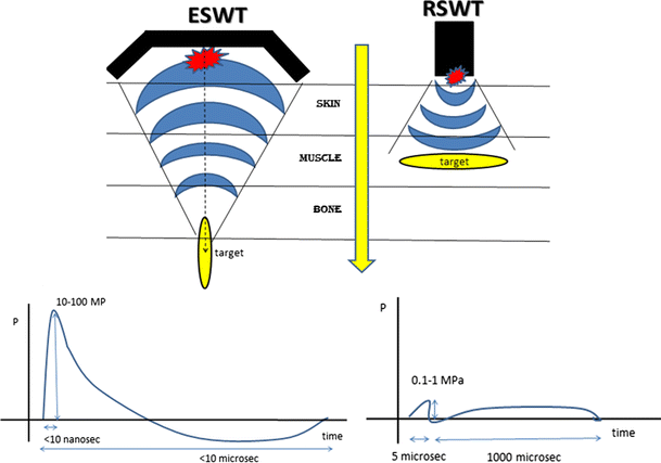 Effects of radial shock waves therapy on osteoblasts activities ...