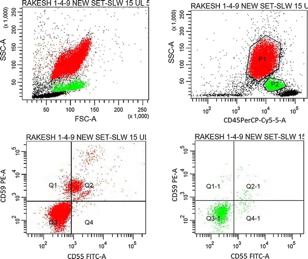 PNH clone assessment by flow cytometry and its clinical correlation in ...
