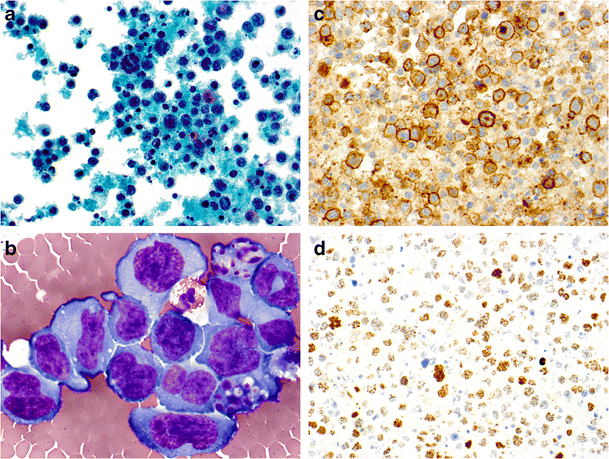 The diversity of diffuse large B-cell lymphoma in extranodal sites ...