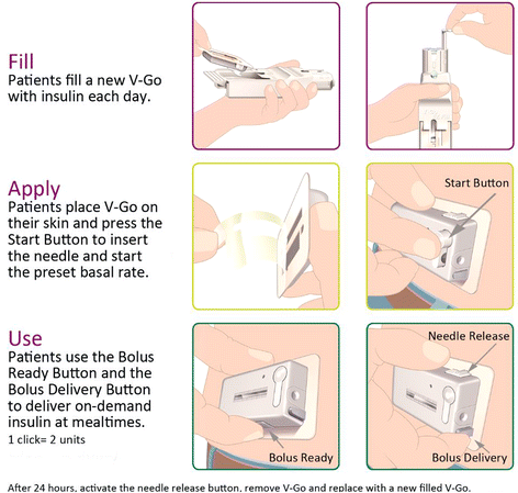 Clinical Benefits Over Time Associated with Use of V-Go Wearable ...