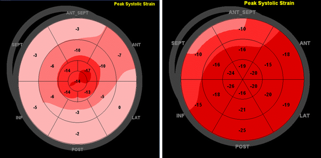 Role of imaging in the diagnosis and management of patients with ...