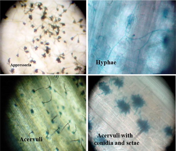 Role of Melanin in Colletotrichum falcatum Pathogenesis Causing ...