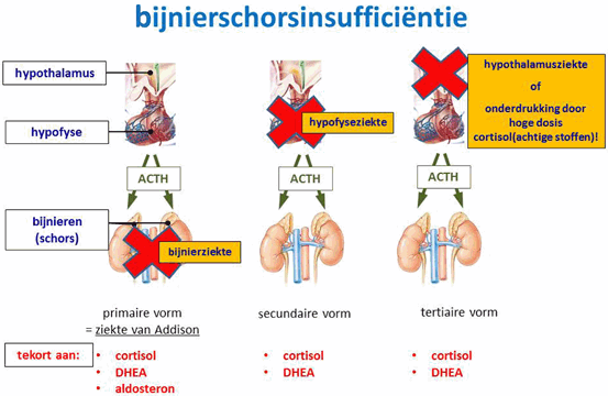 Bijnierschorsinsufficiëntie | SpringerLink