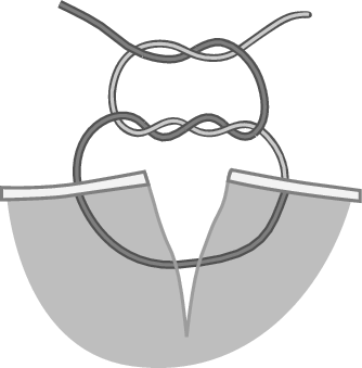 Wondverzorging | SpringerLink