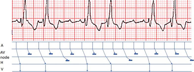 Irregular rhythm? | SpringerLink