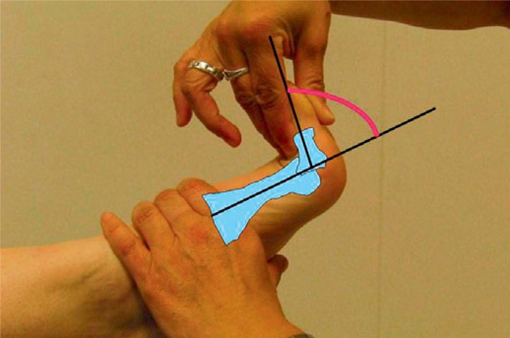 Reproduceerbaarheid dorsaal flexiemeting MTP1-gewricht | SpringerLink