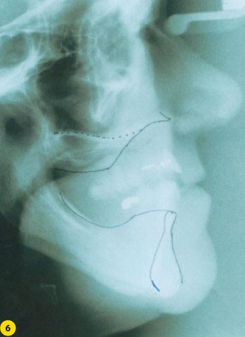 Het syndroom van Kelly | SpringerLink