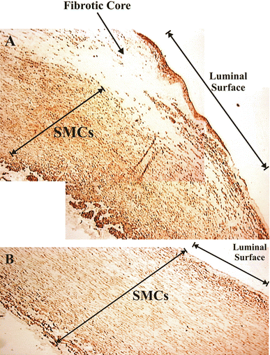 The clinical anatomy of the sinutubular junction | SpringerLink