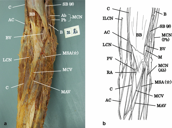Topographical anatomy of superficial veins, cutaneous nerves, and ...