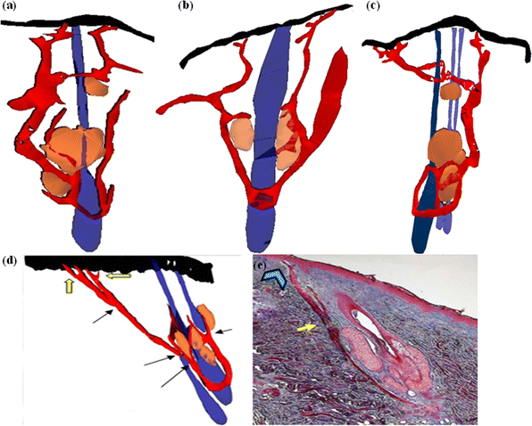 The arrector pili muscle, the bridge between the follicular stem cell ...
