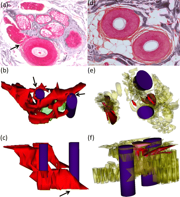 The arrector pili muscle, the bridge between the follicular stem cell ...
