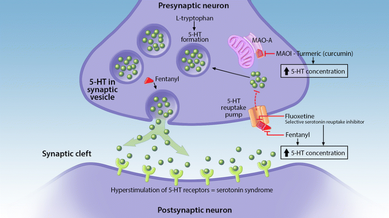 Serotonergic medications, herbal supplements, and perioperative ...
