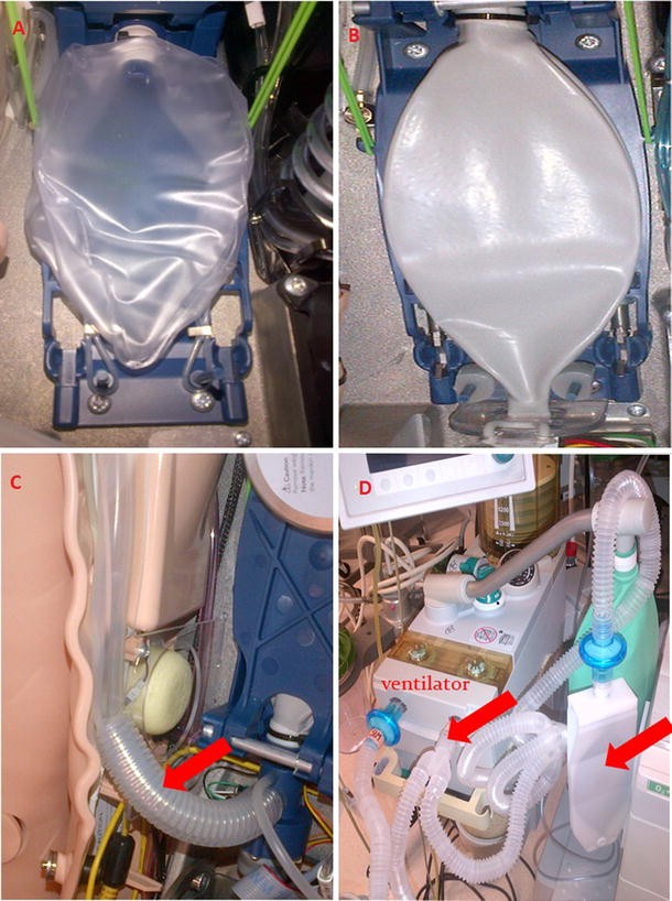 Interventions to improve the mechanical ventilation fidelity of the ...