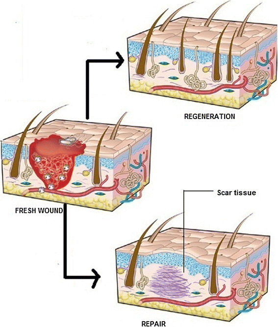 Wound Healing Concepts in Clinical Practice of OMFS | SpringerLink