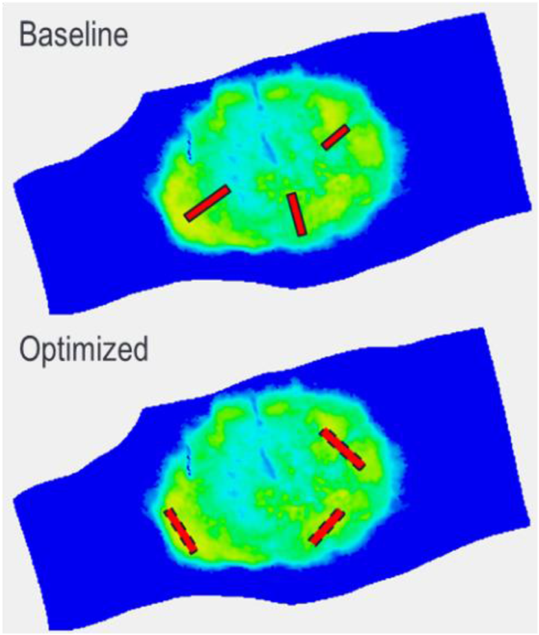 Integrated modeling of a complex oil rim development scenario under ...
