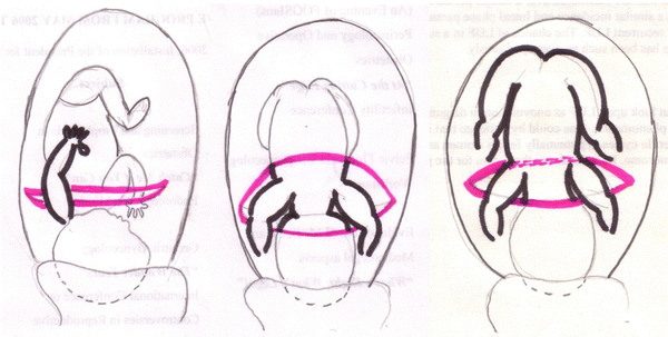 Indian Contribution to Obstetrics and Gynecology | SpringerLink