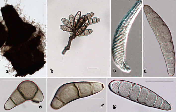 Cochliobolus: an overview and current status of species | SpringerLink