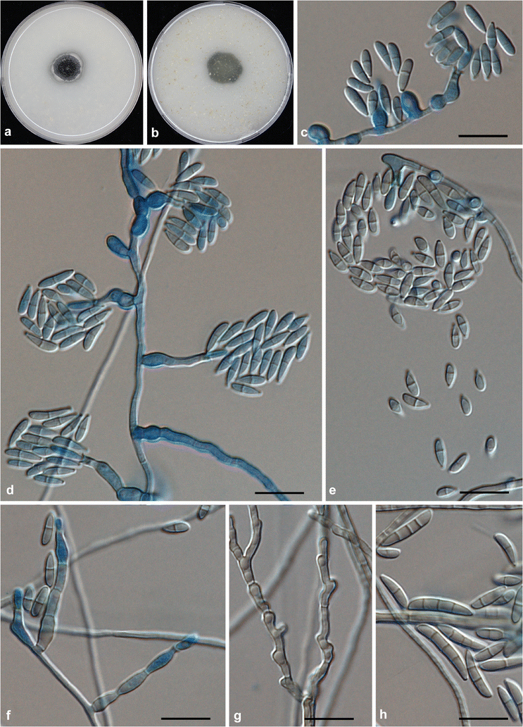 Cyphellophora and its relatives in Phialophora: biodiversity and ...