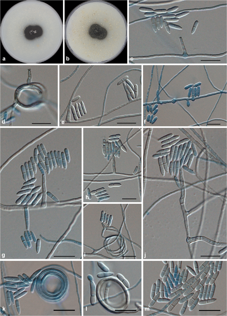 Cyphellophora and its relatives in Phialophora: biodiversity and ...